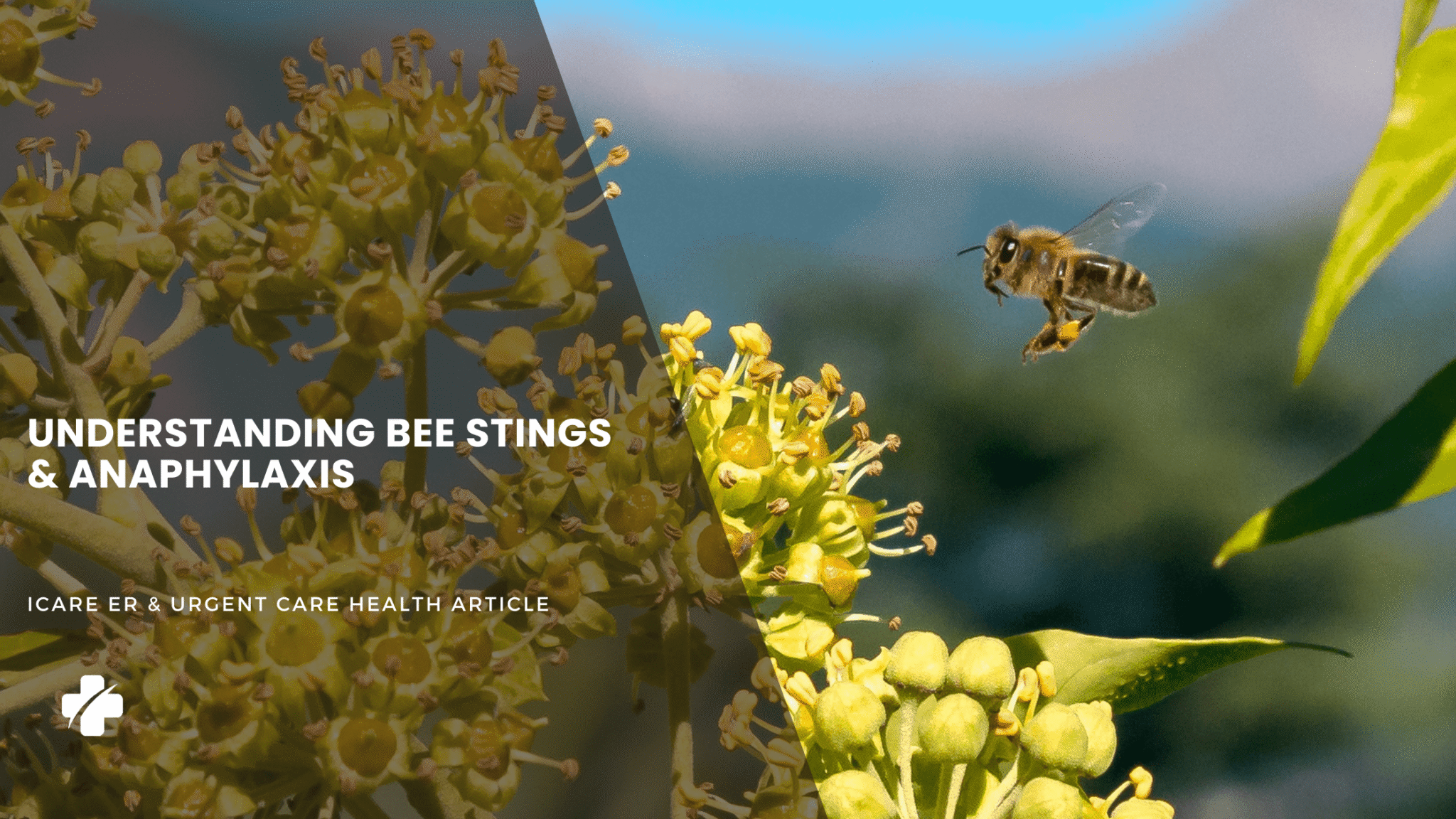 Understanding Bee Stings & Anaphylaxis | iCare ER & Urgent Care