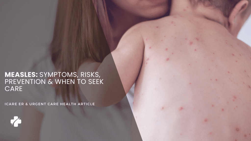 Measles | Symptoms, Risks & Prevention | ICare